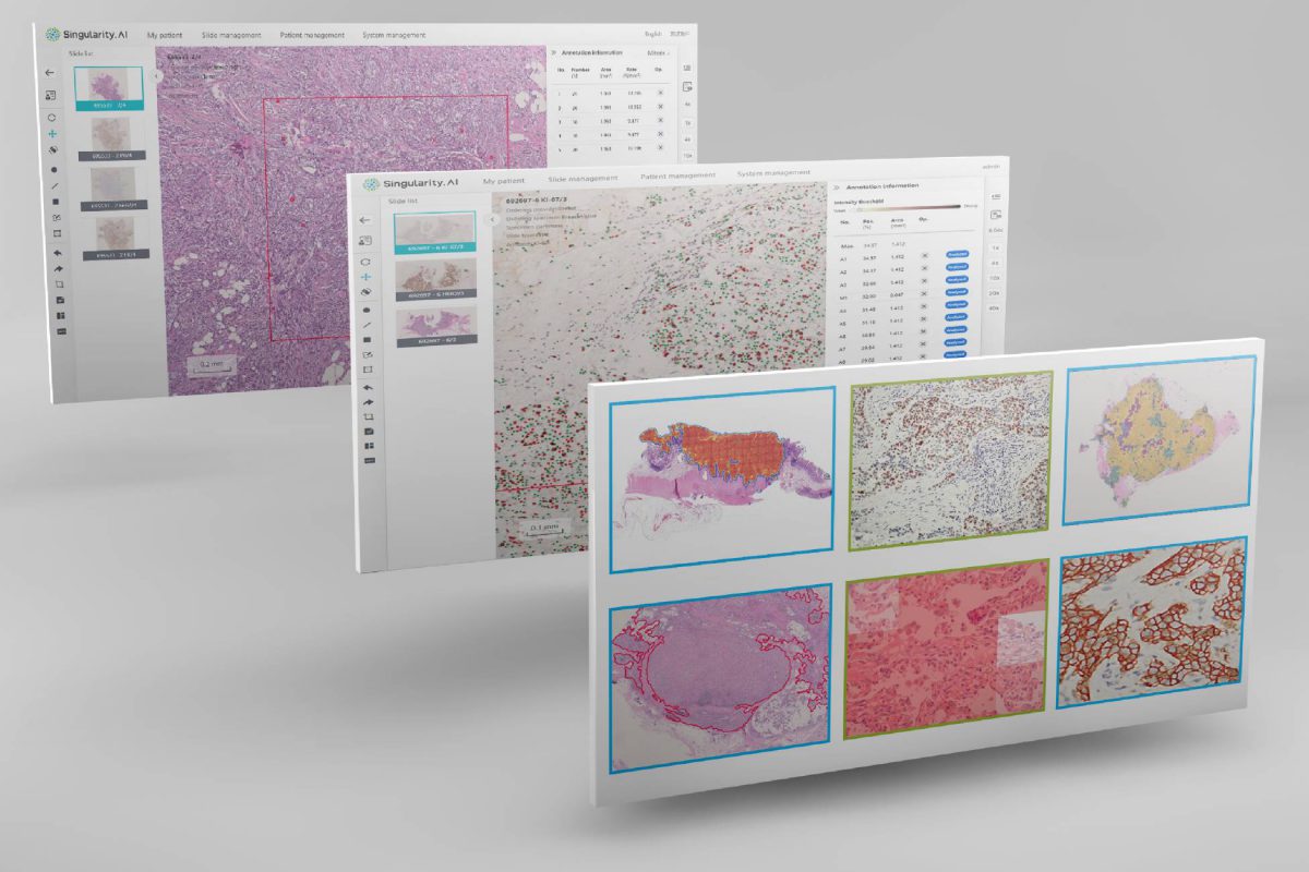 Software Solution - Singularity.AI